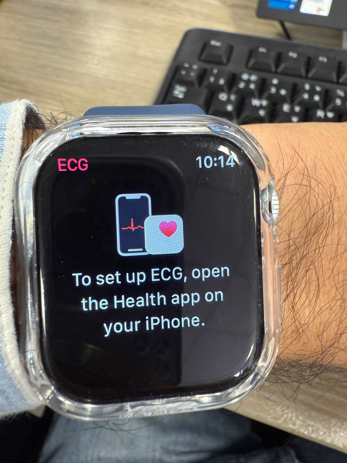 Why is the ECG set up button not appearin… - Apple Community